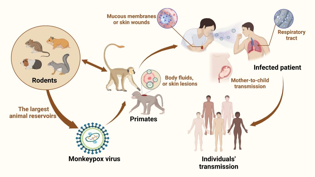 What Do You Need to Know about Monkeypox? - Abdi Waluyo Hospital