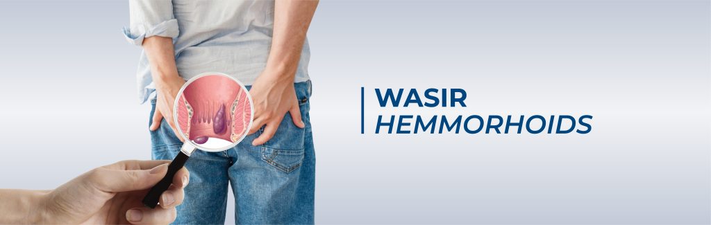 Understanding Treatment Options for Persistent Hemorrhoids - Abdi ...