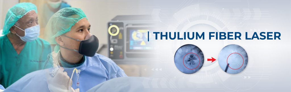 Hilangkan Batu Ginjal dengan Cepat dengan Thulium Fiber Laser (TFL ...
