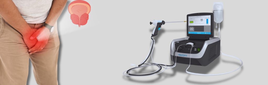 Kesehatan Prostat: Terobosan Terbaru dengan Rezum Vapor Therapy - Abdi ...